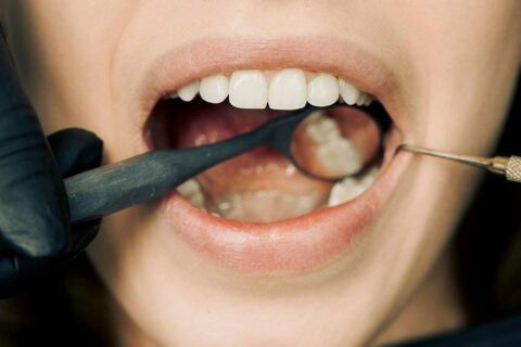 Gums Discoloration Reasons And Treatment: The Truth Behind Dark Gums
