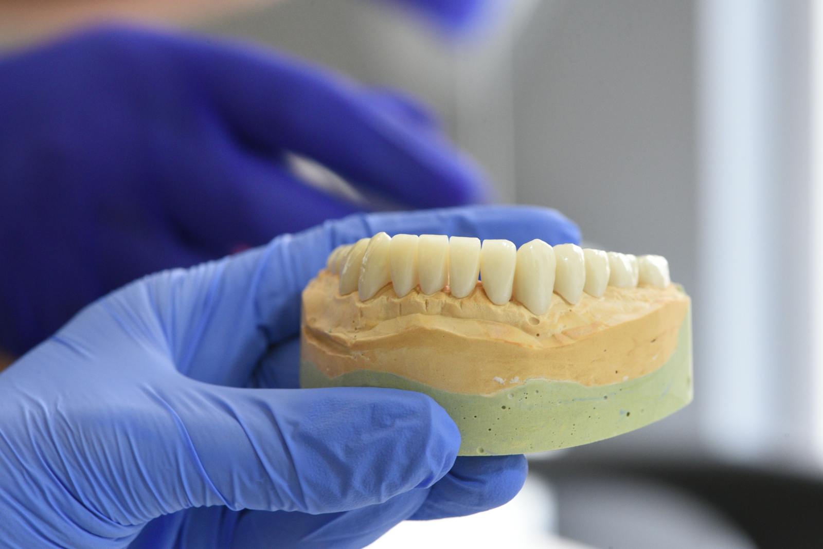 Why Socket Preservation Matters For Dental Implants?