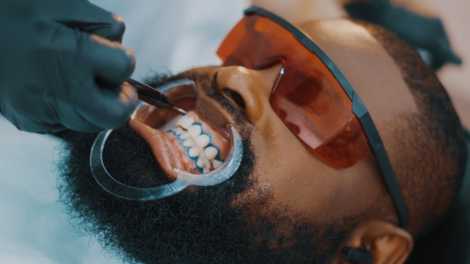 Healthy Gum For Better Teeth, Oral Health: Chewing Sugarless